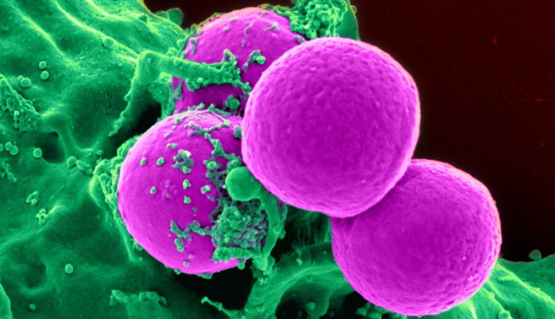 Estafilococo Aureus: Alimentos, Síntomas y Prevención - Curso, Carnet y ...